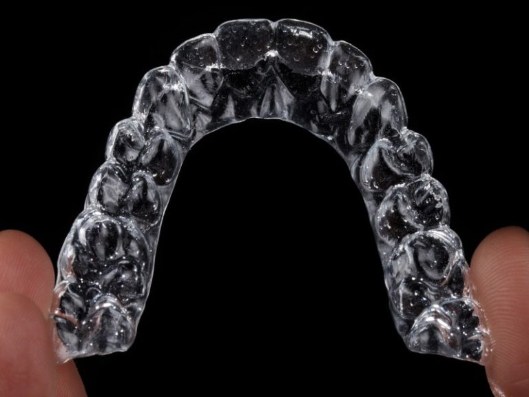¿Qué son los frenillos bucales? - Odontofamily